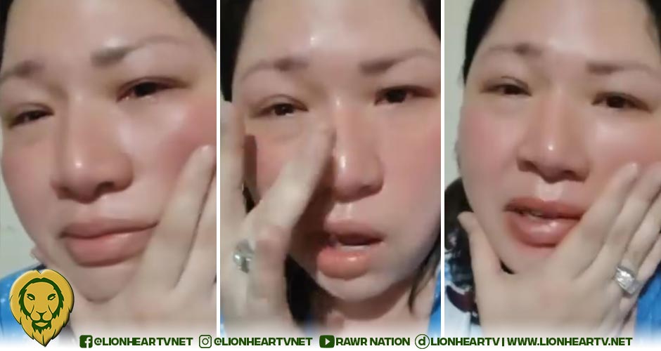 Frenchie Dy faces third Bell’s Palsy attack - LionhearTV